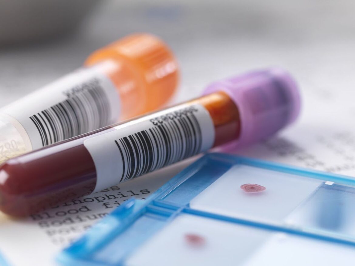 Norme kaliémie : pourquoi surveiller la kaliémie ? - Funny News